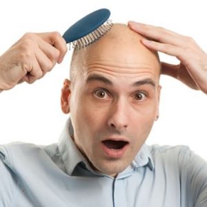 The bald truth about Jewish men’s obsession with their hair - SA Jewish ...