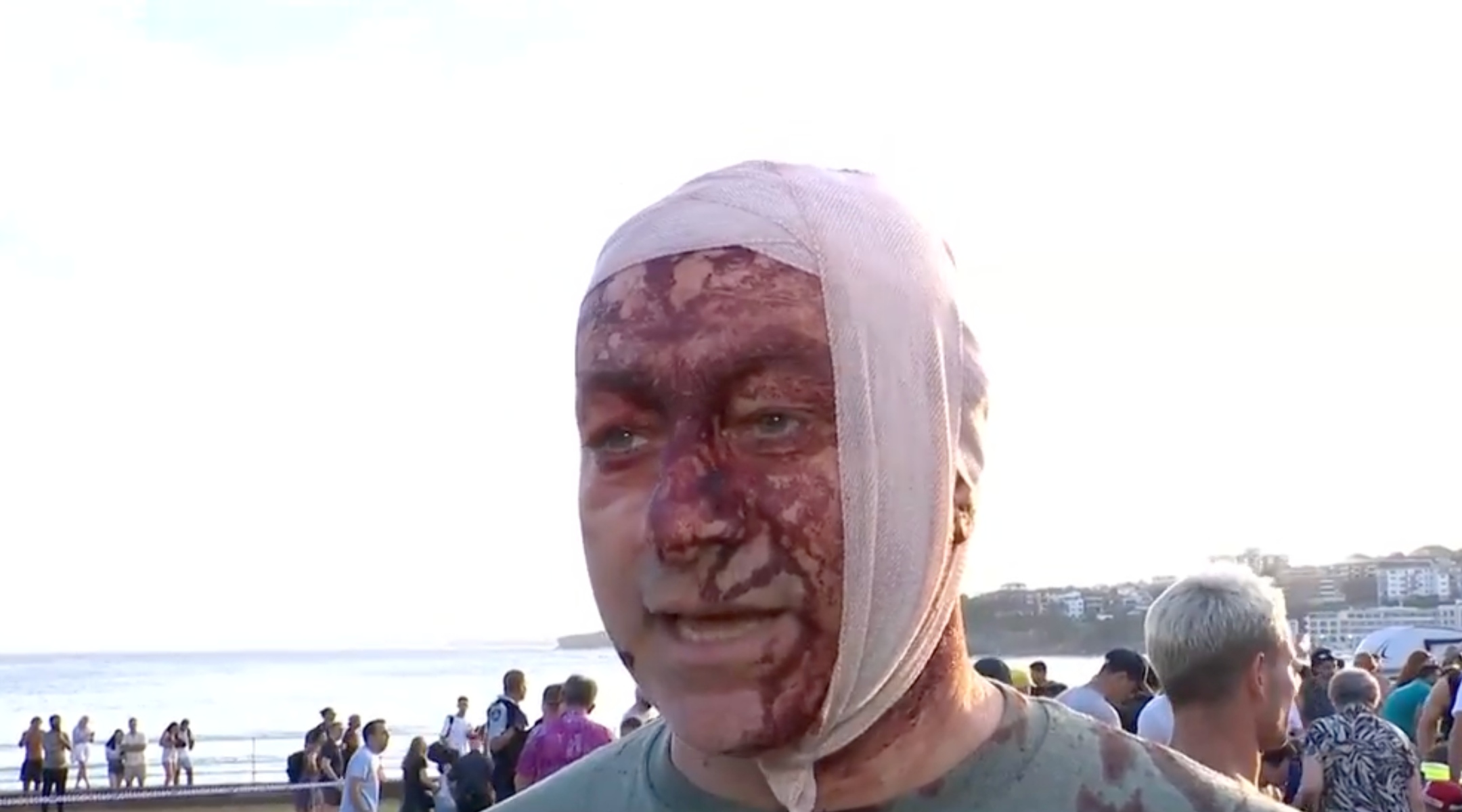 Witnesses, including antisemitism activist, describe ‘absolute bloodbath’ in Bondi Beach ...